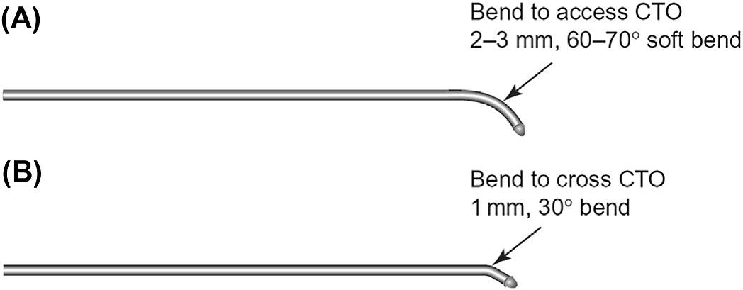 Prof. Dr. Alp Aydınalp / Kronik Total Oklüzyon Antegrad Yaklaşım